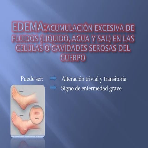 Escala edema | PDF
