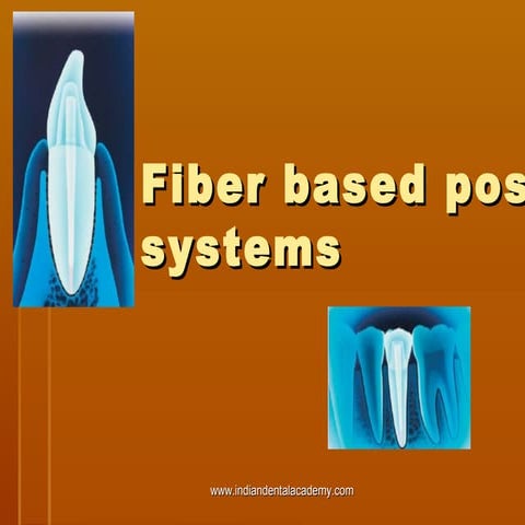 Fiber based post systems /certified fixed orthodontic courses by Indian ...