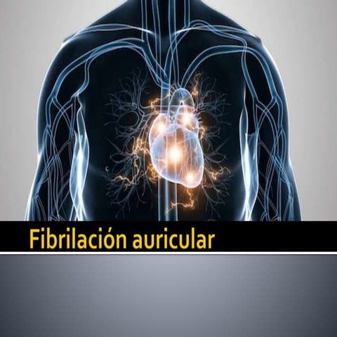 Fibrilación auricular | PPTX
