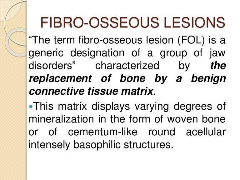 Benign Fibro Osseous Lesion Treatment – YVDL