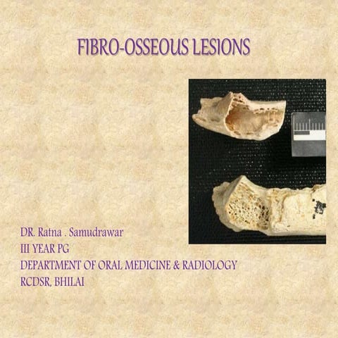 Fibro osseous lesions | PPTX