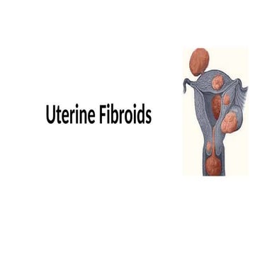 Fibroid abnormal uterine bleed OBG phase | PPTX