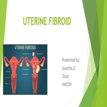 Uterine fibroids | PPTX