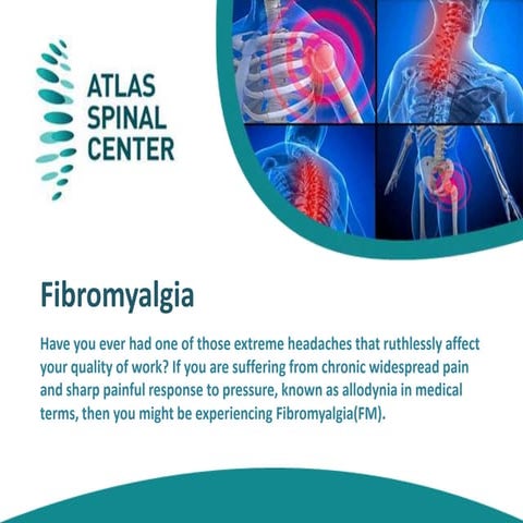 What is Fibromyalgia? | PPTX