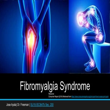 Fibromyalgia Presentation | PPTX