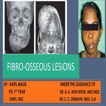Fibro osseous lesion | PPSX