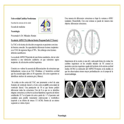 Neurologia escala de ASPECT evaluacion de un paciente neurologico | DOCX