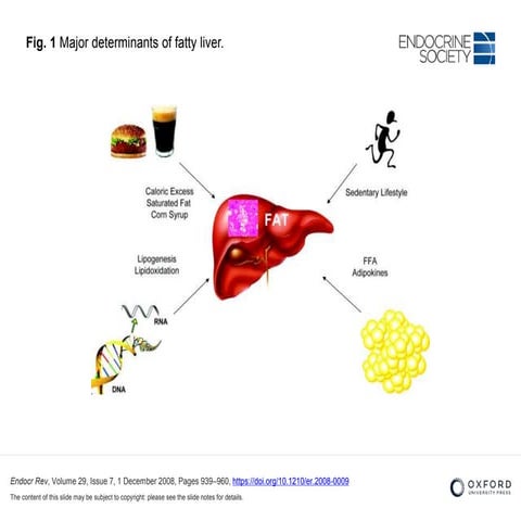 Fatty Liver | PPTX