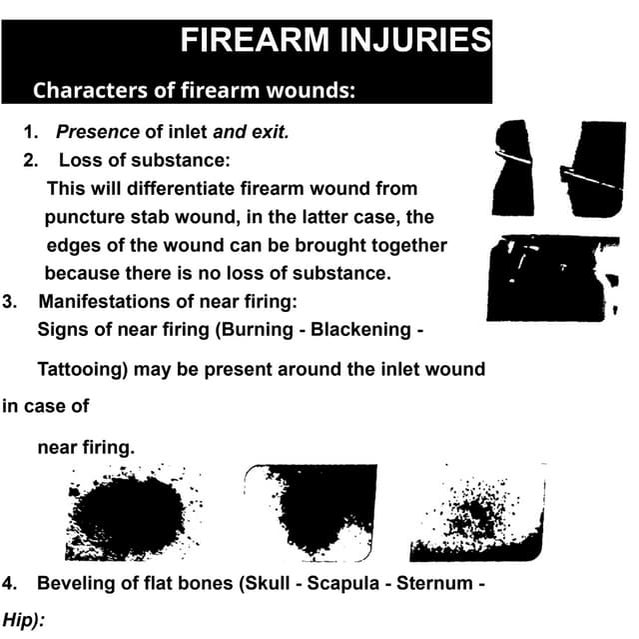 Firearm injury and firearmweapons ppt.doc
