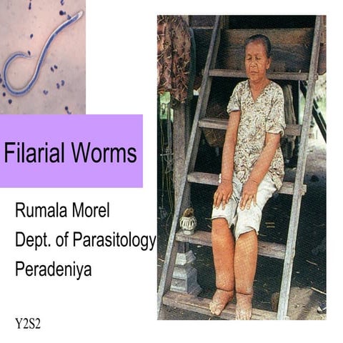 Filariasis