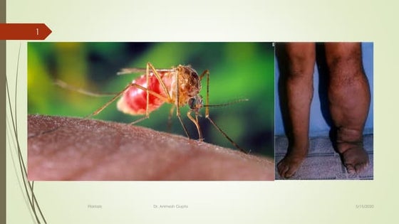 Filariasis laboratory diagnosis | PPT
