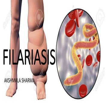 Filariasis | PPTX