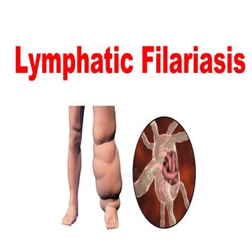 Filariasis I Lymphatic Filariasis I Community Medicine | PPTX