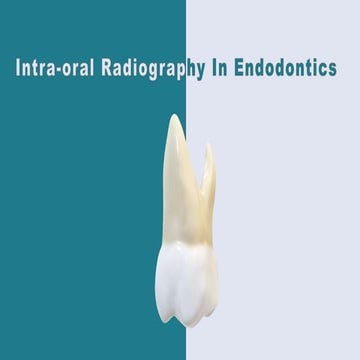 X-rays uses and benefits in endodontic treatment | PPTX