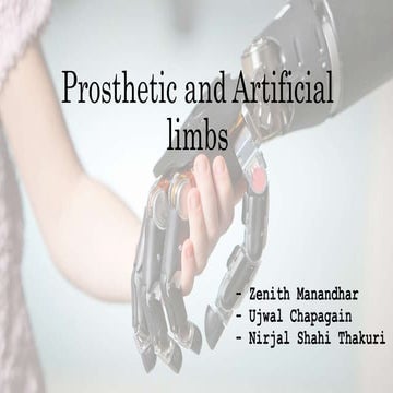 PROSTHETIC MANAGEMENT OF TRANSTIBIAL AMPUTATION AND ITS BIOMECHANICS | PDF