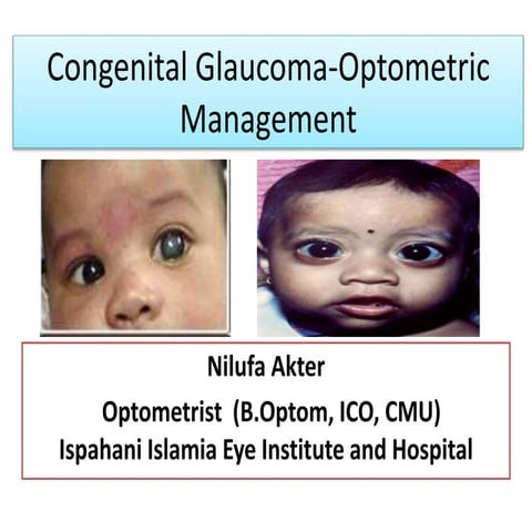 Congenital Glaucoma-Optometric managment.ppt