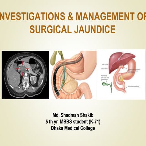 Surgical Jaundice investigations & management | PPTX