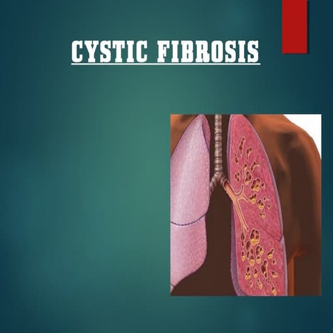 cystic fibrosis | PPT