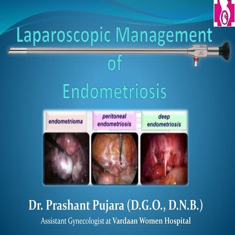 Laparoscopic management of endometriosis | PPTX