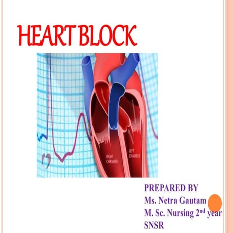 Heart block | PPTX