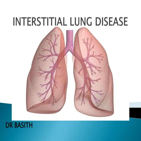 interstitial lung diseases | PPTX