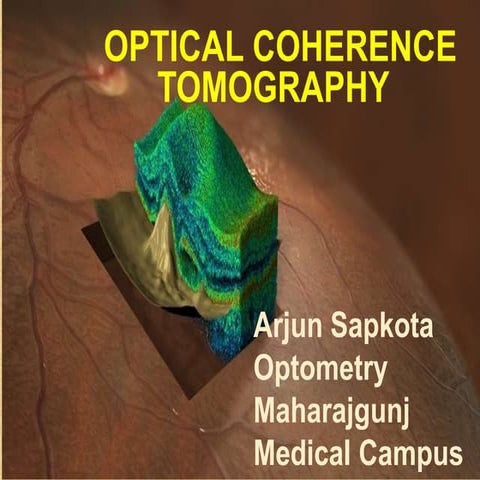 Optical Coherence Tomography | PPTX