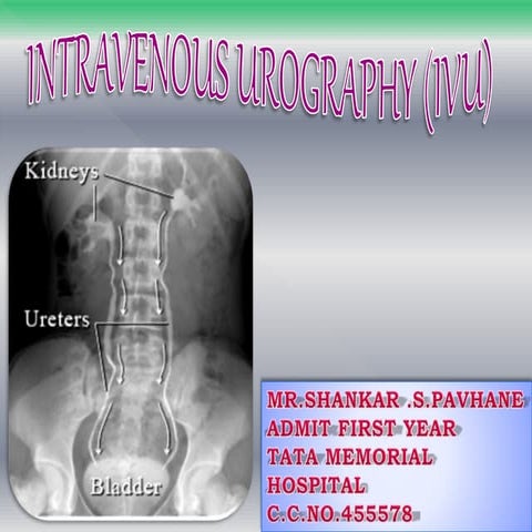 INTRAVENOUS UROGRAM | PPTX