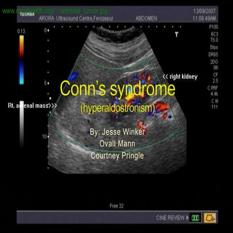 Final production conn's | PPTX