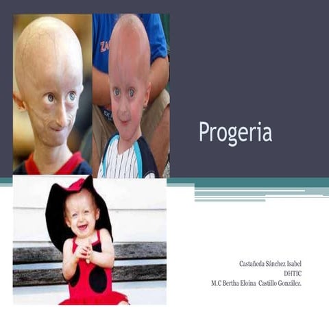 Progeria | PPTX
