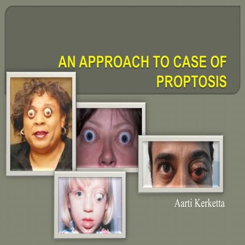 Proptosis | PPTX