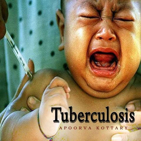 Introduction to Pediatric Tuberculosis | PPTX