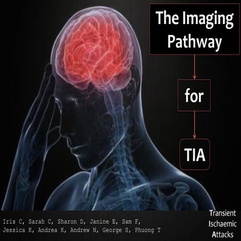 Transient Ischaemic Attack - Imaging Pathways | PPTX
