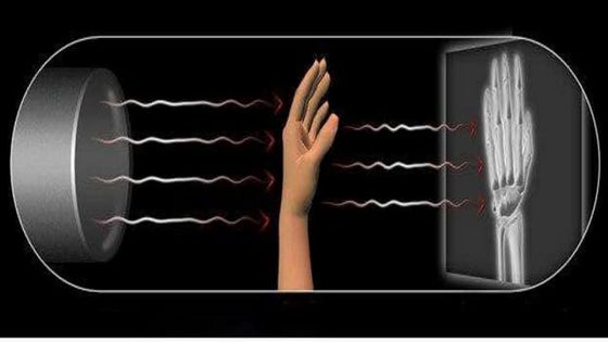 Radiographic image formation | PPT