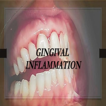 Final year class - gingival inflammation.pptx