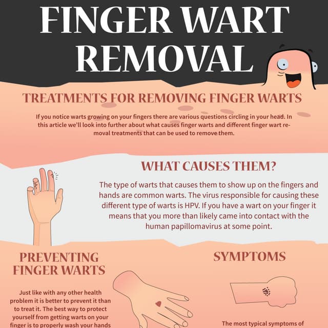 Finger wart removal | PDF