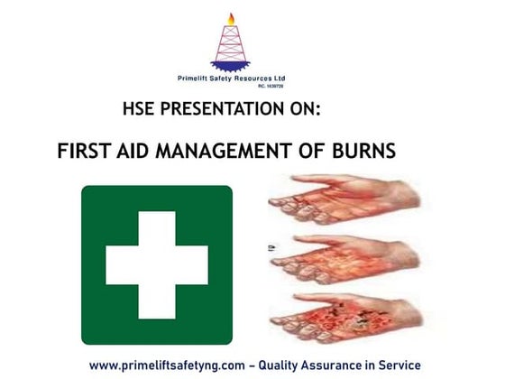Burns first aid | PPT