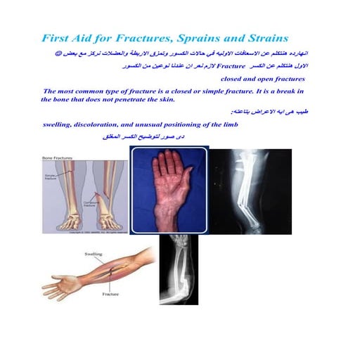 First aid in fracture , sprain and srtain | PDF