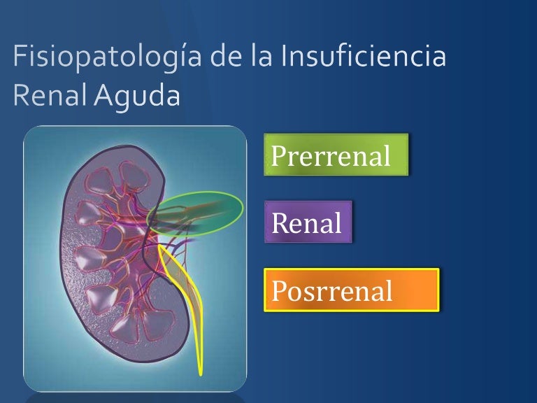 Fisiopatología de la insuficiencia renal aguda
