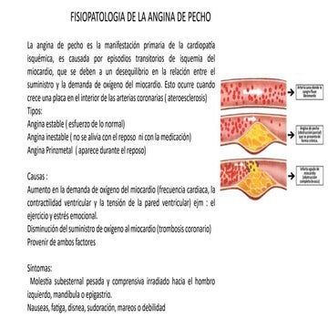fisiopatologia de la angina de pecho..pptx