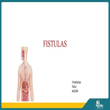 fistula.pptx | Digestive Disorders | Diseases and Conditions