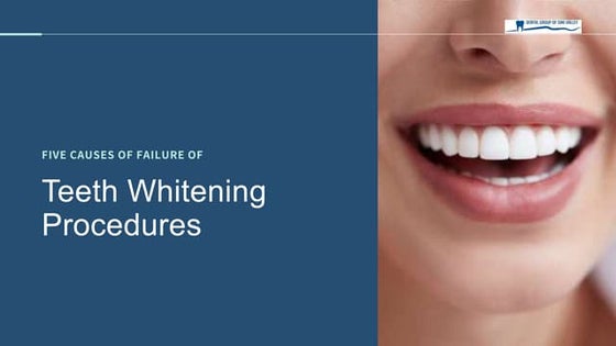Zoom teeth whitening | PDF