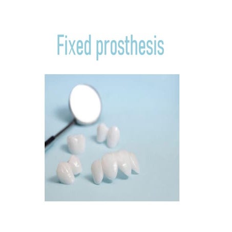 cast and die preparation in fixed prosthodontics | PDF