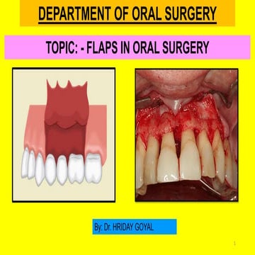 MASTERING FLAPS IN ORAL & MAXILLOFACIAL SURGERY | PDF