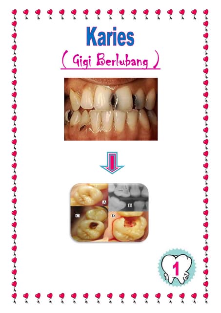 Keterangan plak dan disclosing solution | DOCX