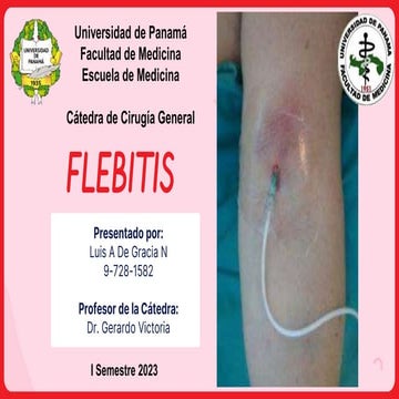 Flebitis En La Mano SINOVITIS DE LOS TENDONES DE LA MANO | Blog Del Dr