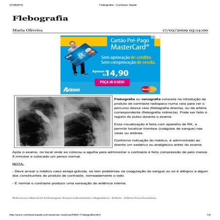 Flebografia conhecer saúde | PDF
