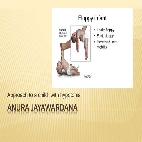 Approach to a child with hypotonia.pptx