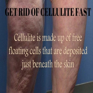 How to get rid of cellulite fast | PPT