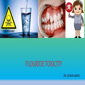 FLOURIDE TOXICITY IN DENTISTRY .pptx