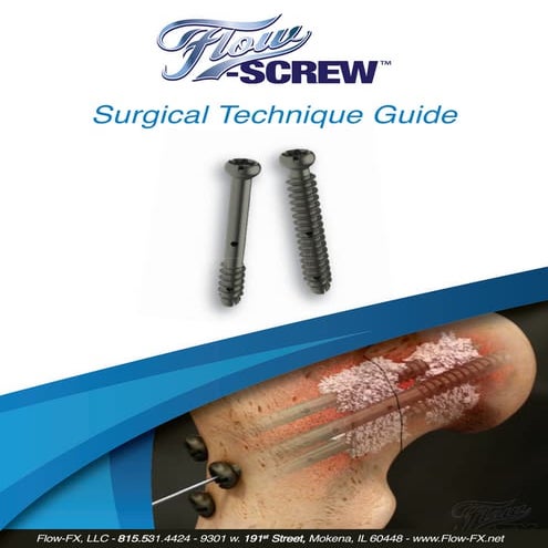 Flow-FX Flow Screw ~ Surgical Technique Guide | PDF
